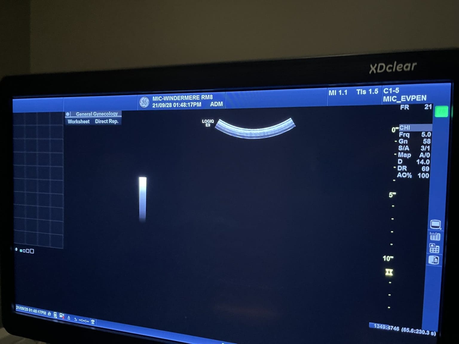 My Experience With Pelvic Ultrasounds And Some Tips For Yours